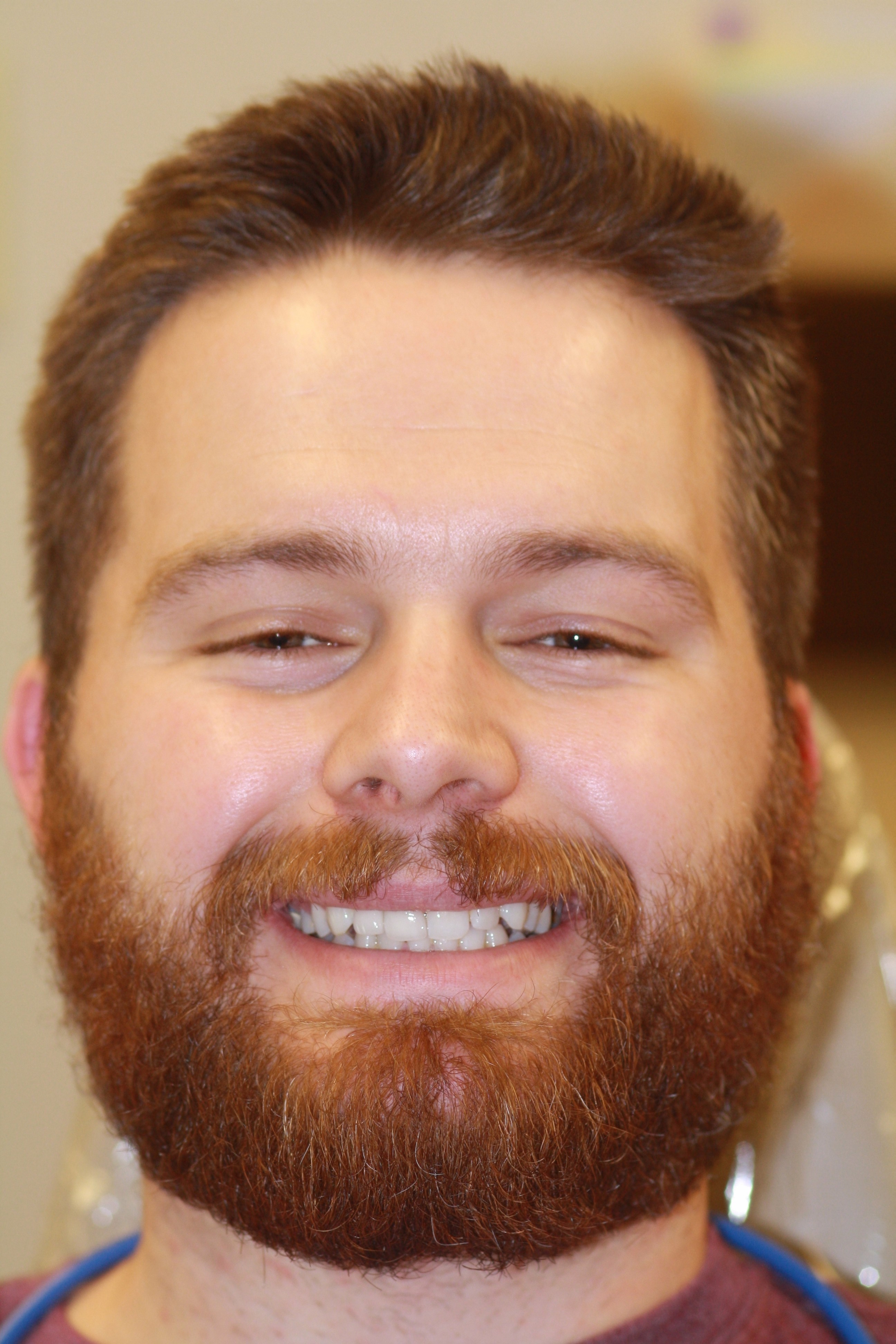 jeremy after | First Impression Dentistry
